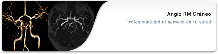 Resona :: Angio RM Cráneo