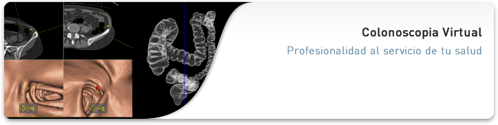 Resona :: Colonoscopia Virtual