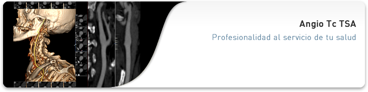 Resona :: Angio Tc TSA